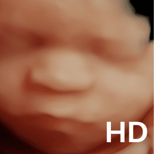 8k image NEW - First Glimpse Ultrasound